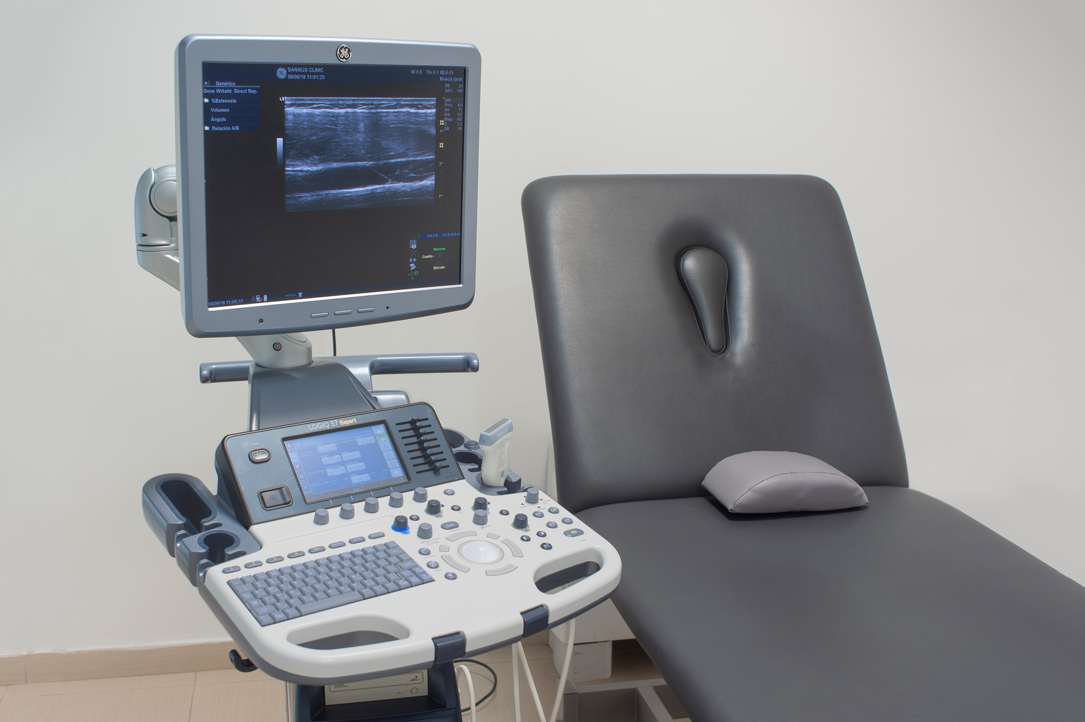 Ecografo – Sannus Clinic